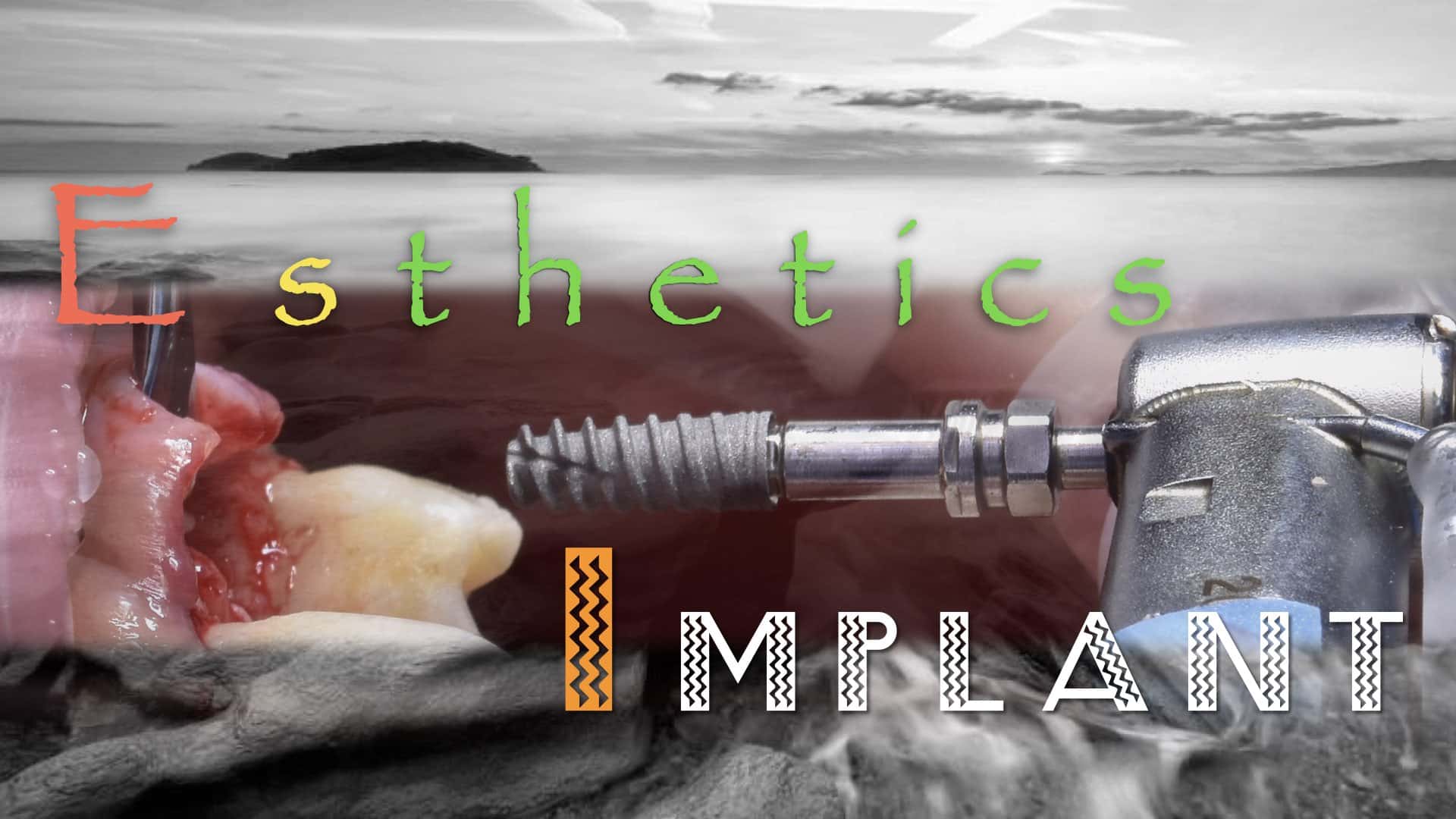 Esthetic Implant - MyZerodonto
